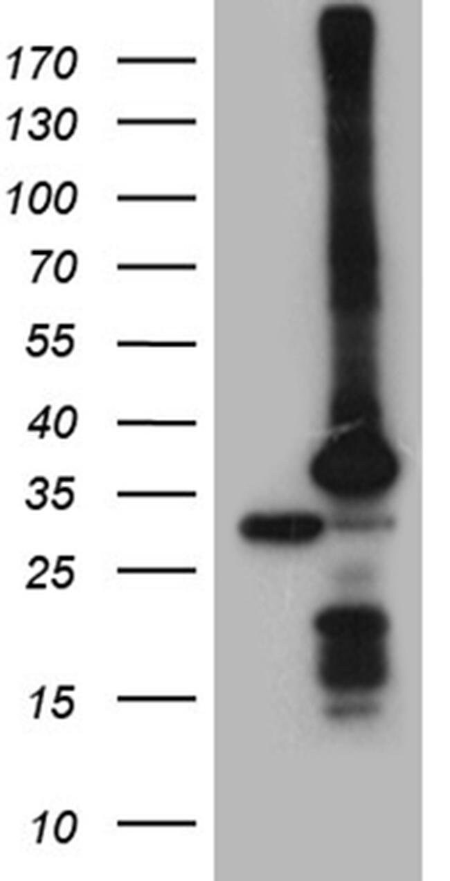 PSMA7 Monoclonal Antibody (OTI1G1), TrueMAB™, OriGene 100 μL ...