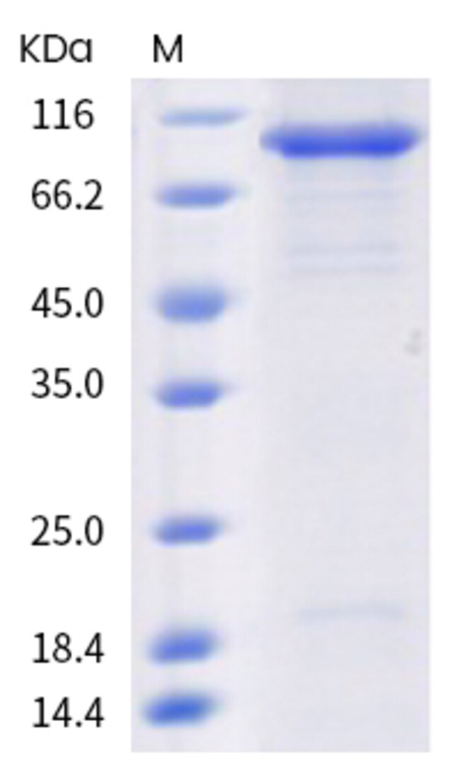 Invitrogen SARS-CoV-2 RDRP His-tag Recombinant Protein 100 μg | Buy ...