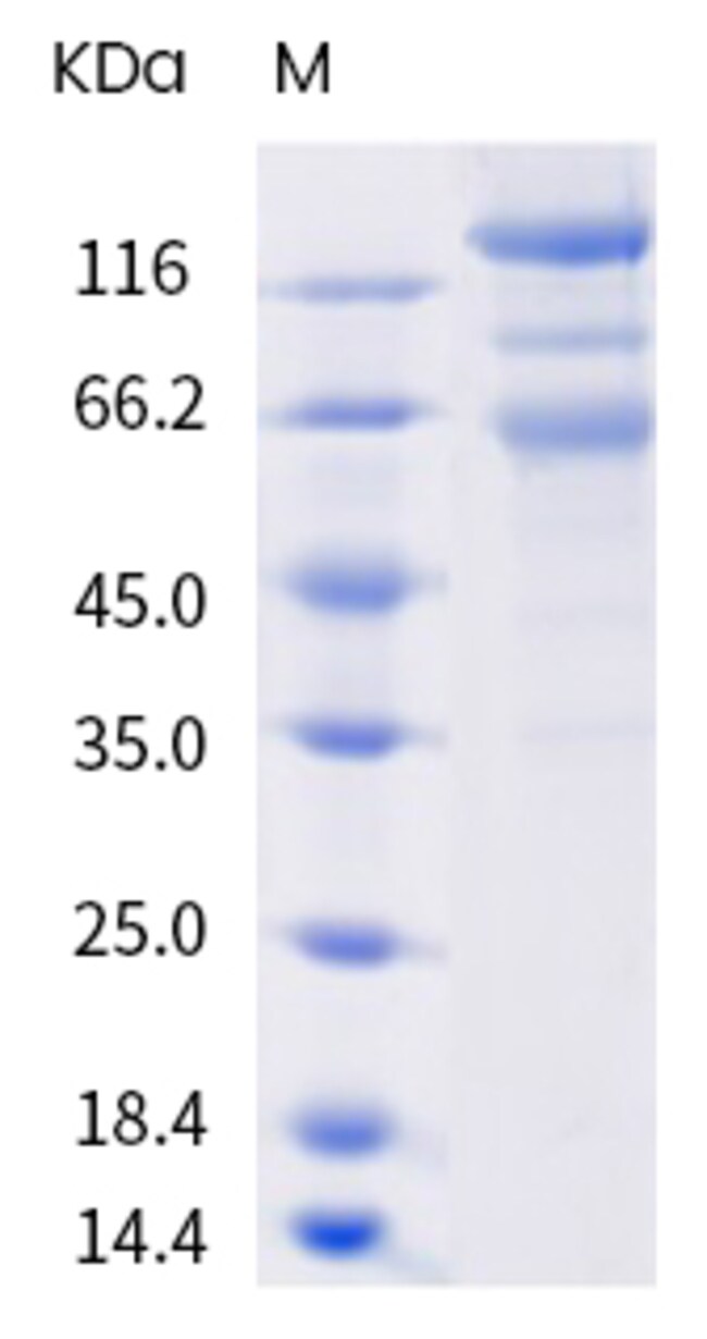 Invitrogen SARS-CoV-2 Spike Protein S1/S2 (B.1.351) His-tag Recombinant Protein 100 μg | Buy ...