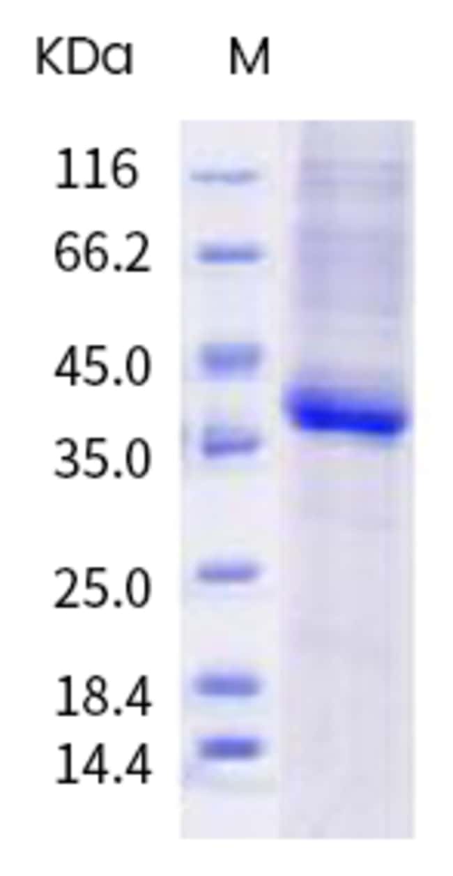 Invitrogen SARS-CoV-2 Spike Protein (RBD) (N487D) His-tag Recombinant ...