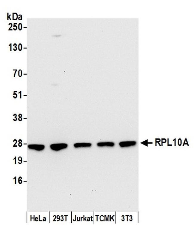 RPL10A/Ribosomal Protein L10a, Polyclonal, Bethyl Laboratories ...