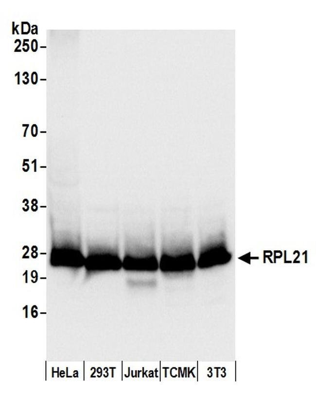 RPL21/Ribosomal Protein L21, Polyclonal, Bethyl Laboratories:Antibodies ...