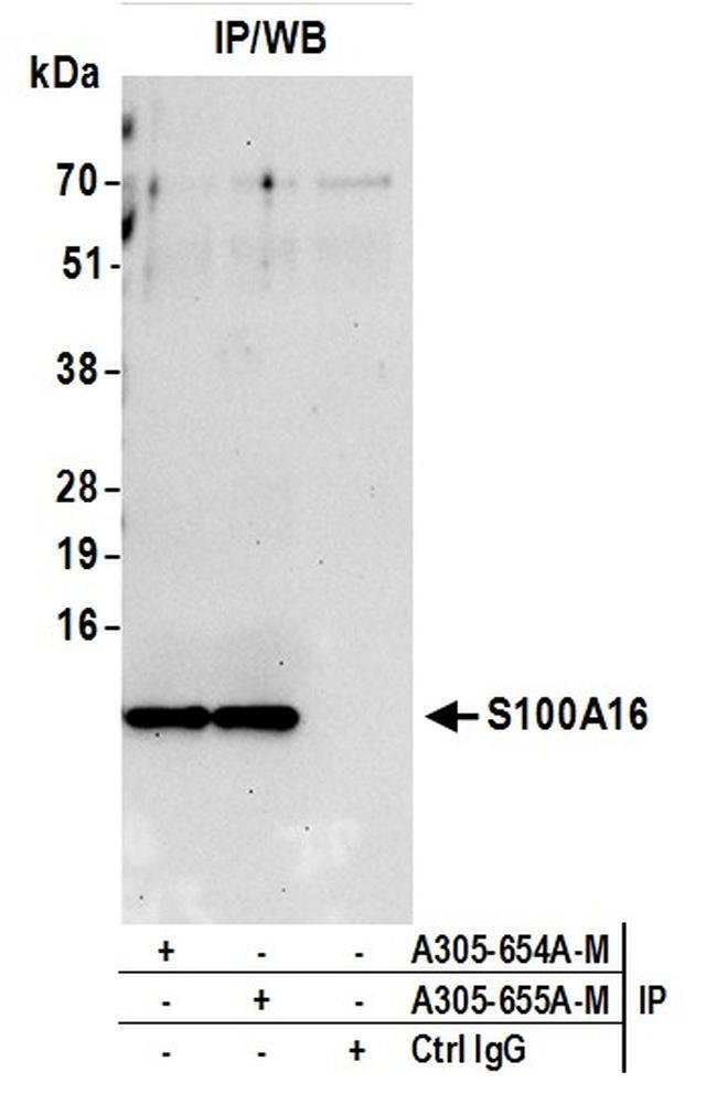 S100A16, Polyclonal, Bethyl Laboratories:Antibodies:Primary Antibodies ...