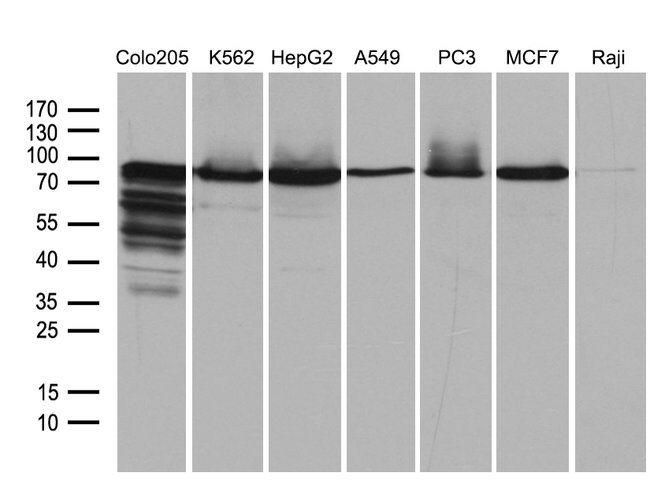 SEC23B Monoclonal Antibody (OTI1B2), TrueMAB , OriGene 100 μL ...