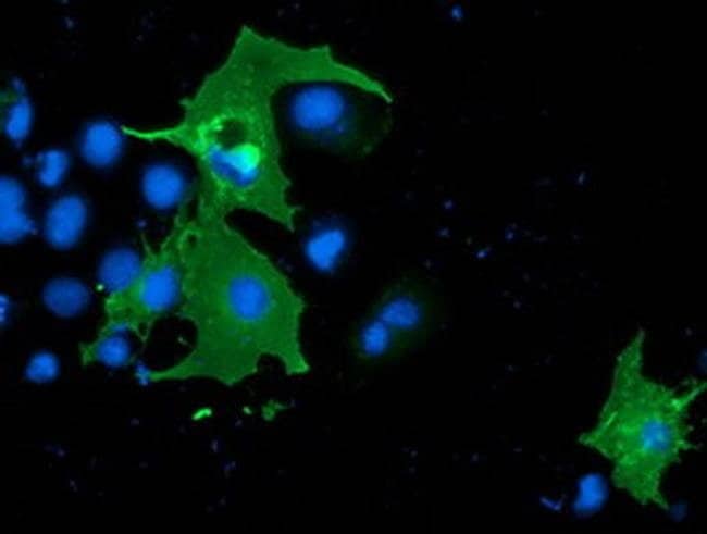 SH2B3 Mouse anti-Human, Clone: OTI2C9, TrueMAB , Origene 30 μL ...