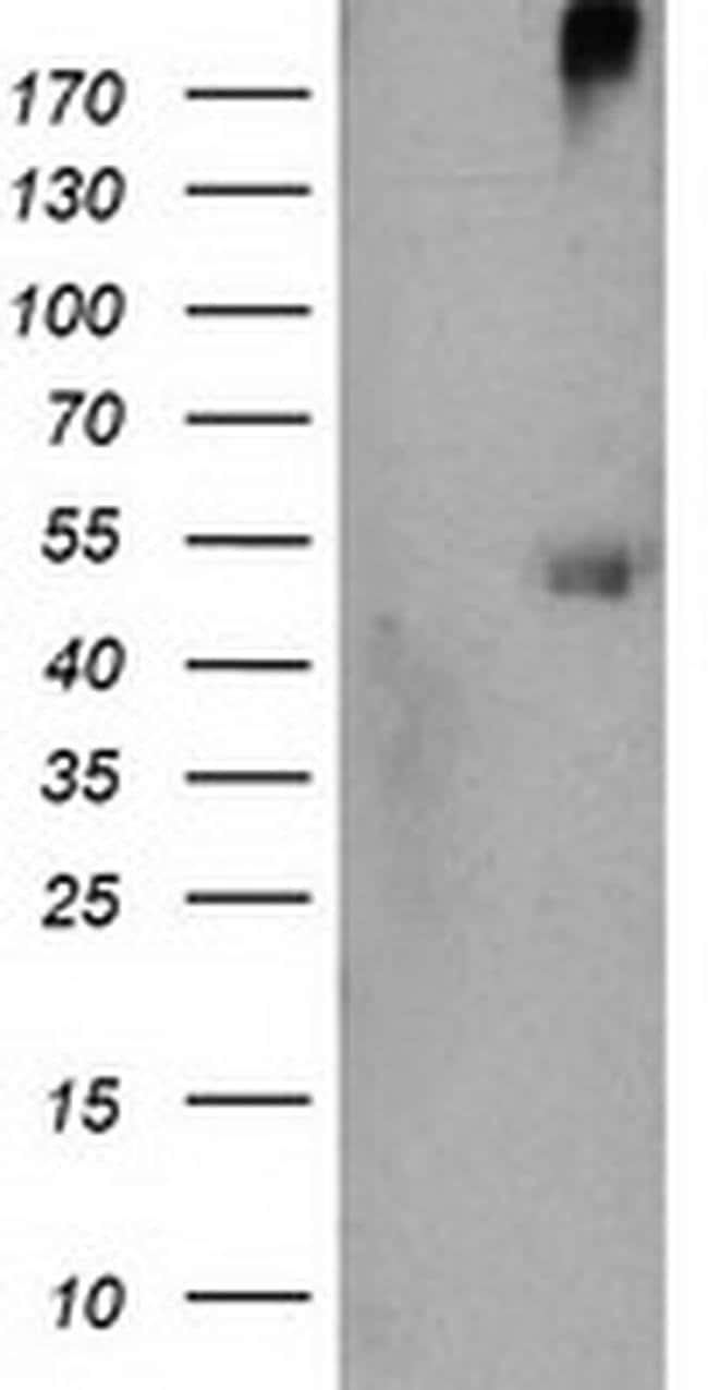 SHPK Monoclonal Antibody (OTI3D7), TrueMAB™, OriGene 30 μL ...
