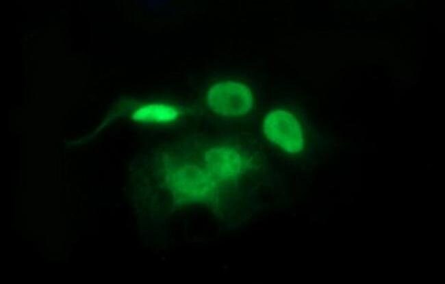 SIVA1 Monoclonal Antibody (OTI1D6), TrueMAB , OriGene 100 μL ...