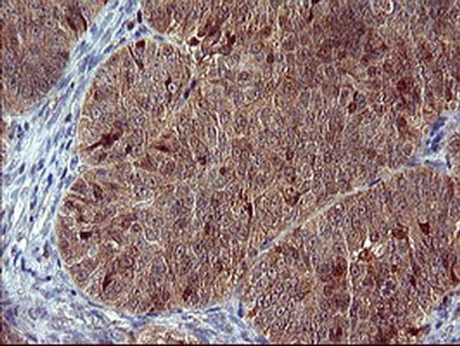 SIVA1 Monoclonal Antibody (OTI1D6), TrueMAB , OriGene 100 μL ...