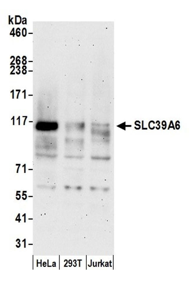 SLC39A6, Polyclonal, Bethyl Laboratories:Antibodies:Primary Antibodies ...