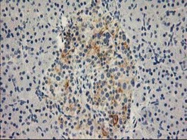 SNAP25 Mouse anti-Human, Clone: OTI 1D5, lyophilized, TrueMAB™ 100 μg ...