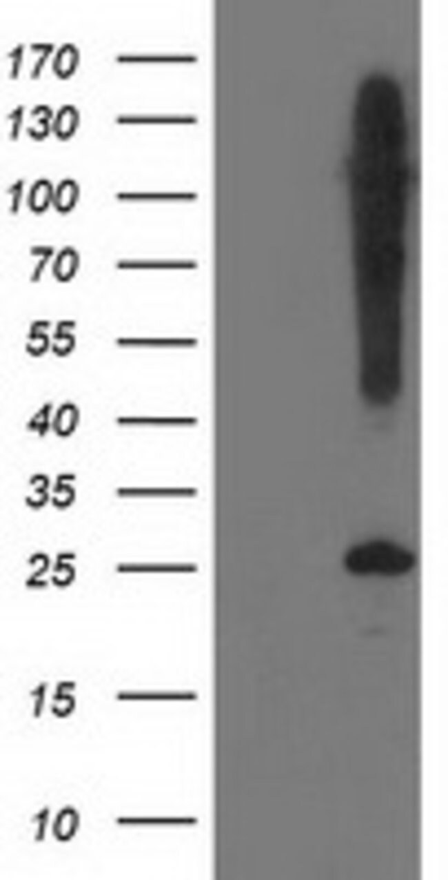 SNAP25 Mouse anti-Human, Clone: OTI 1D5, lyophilized, TrueMAB 100 μg ...