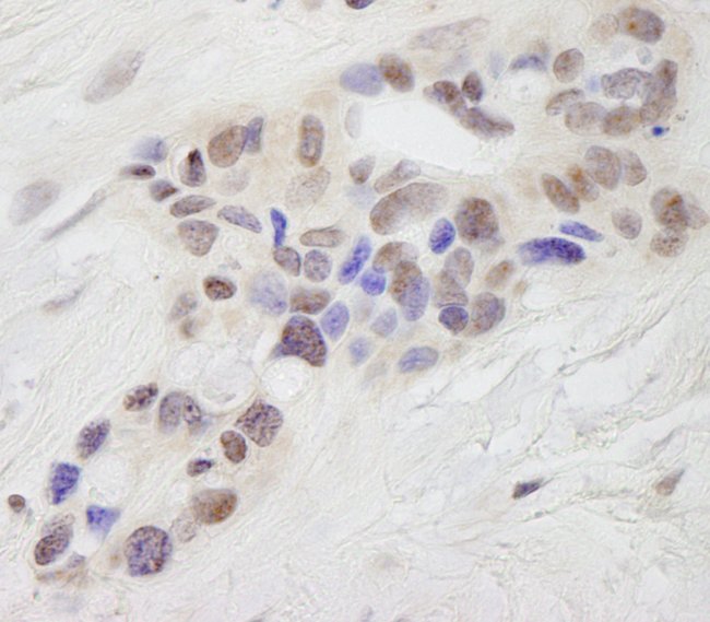 STAT6 IHC, Polyclonal, Bethyl Laboratories:Antibodies:Primary ...