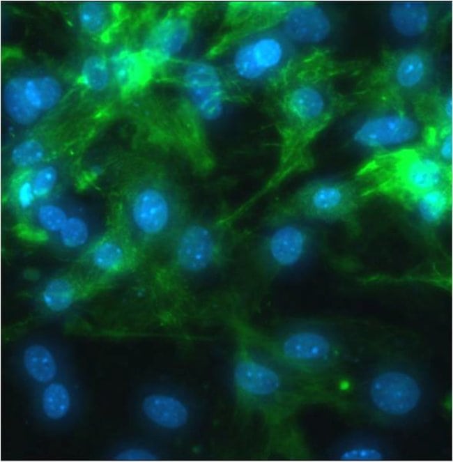 Invitrogen Sarcomeric alpha Actin Monoclonal Antibody (5C5) 500 μL ...