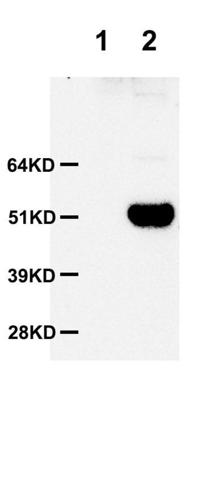SARS-CoV-2 N Protein Human anti-Virus, Clone: OTIH3C6, Origene 100 μL ...
