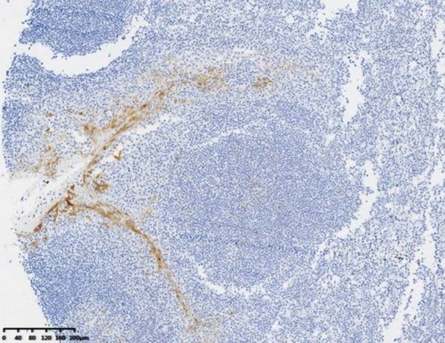 P16 (CDKN2A) Recombinant Rabbit Monoclonal Antibody (OTIR5G10), TrueRAB | Fisher Scientific