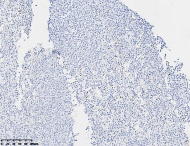 Perforin-1 Monoclonal Antibody (OTI10A2), TrueMAB , OriGene 30 μL ...