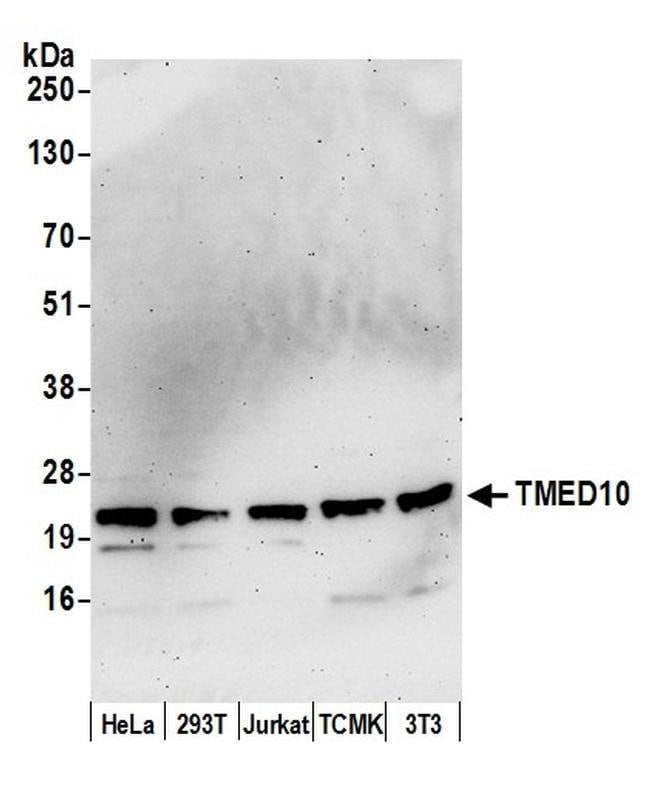 TMED10/TMP21, Polyclonal, Bethyl Laboratories :: | Fisher Scientific