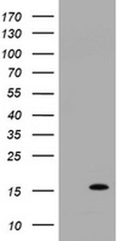 TSC22D3 Monoclonal Antibody (OTI5D3), TrueMAB , OriGene 100 μL ...