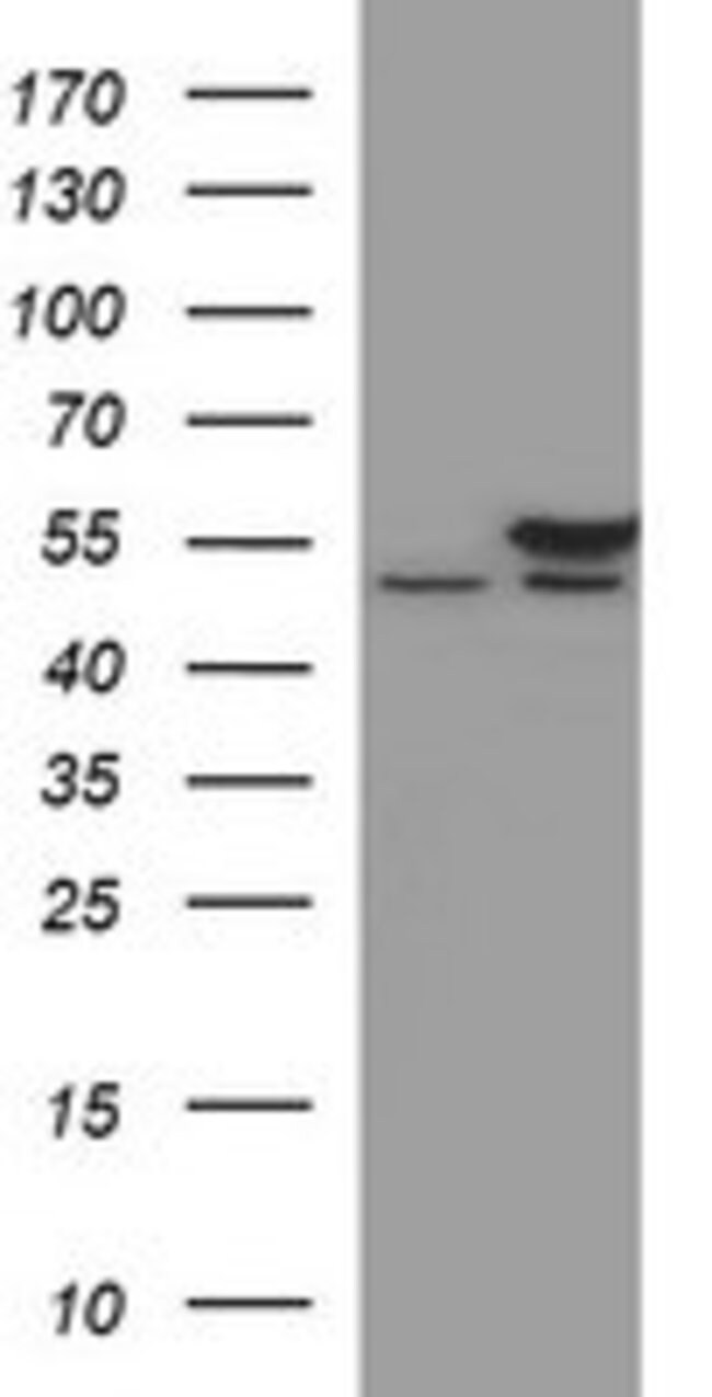 TUBB2B Mouse anti-Human, Clone: OTI5H9, lyophilized, TrueMAB 100 μg ...