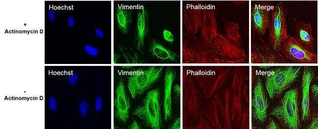 Vimentin Monoclonal Antibody (SP20), Invitrogen 500 μL; Unconjugated ...