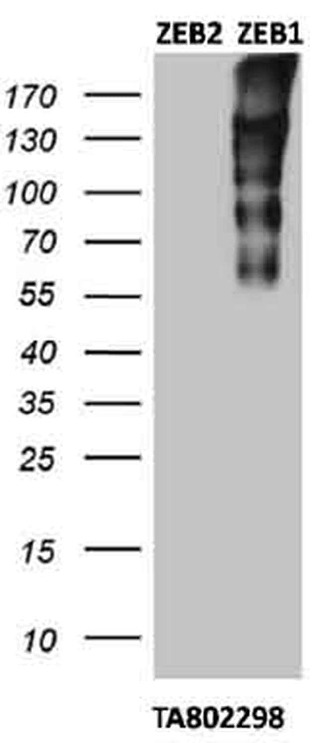 ZEB1 Mouse anti-Human, Clone: OTI3G6, liquid, TrueMAB™ 100 μL ...