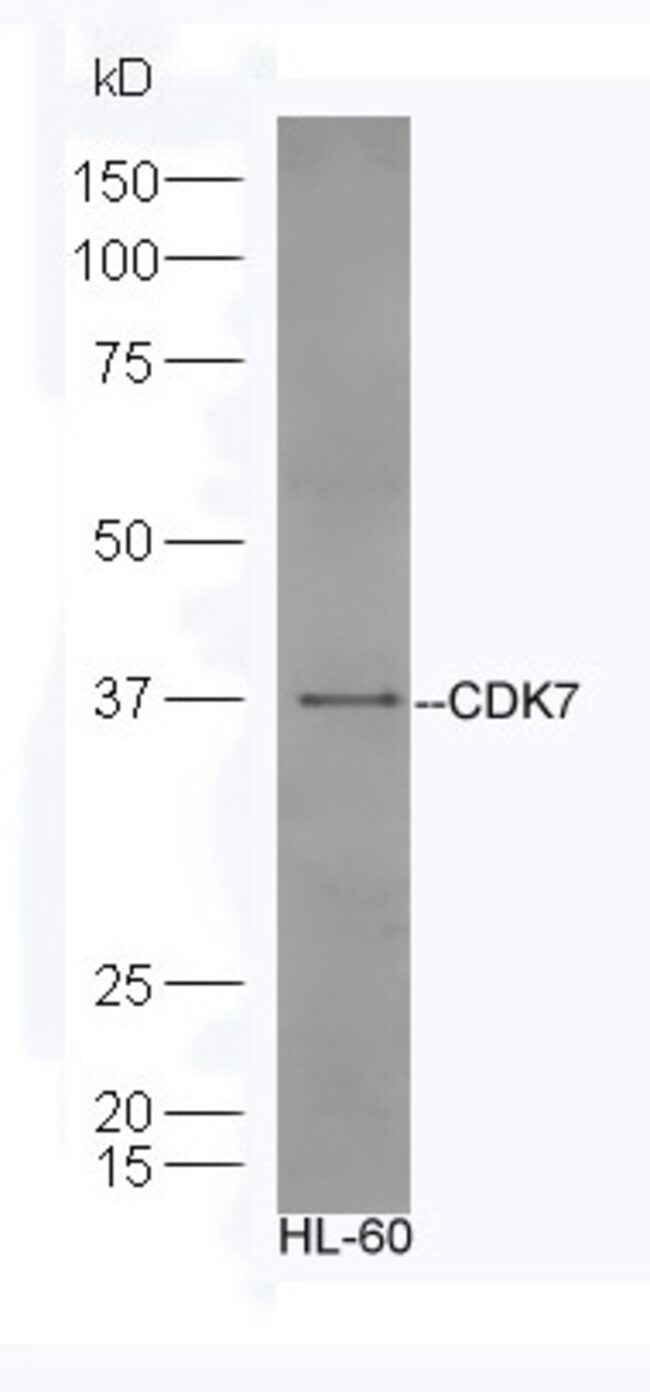 CDK7 Rabbit anti-Human, Polyclonal, Bioss 100 μL; Unconjugated ...