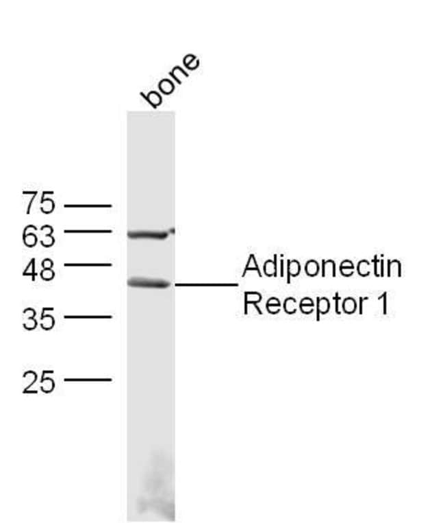 Adiponectin Receptor 1 Rabbit anti-Human, Polyclonal, Bioss 100 μL ...