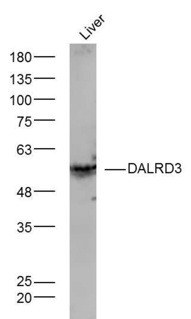 DALRD3 Rabbit anti-Human, Polyclonal, Bioss 100 μL; Unconjugated ...