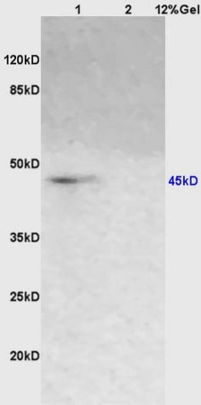 A2AR/Adenosine A2a receptor Rabbit anti-Human, Polyclonal, Bioss 100 μL ...