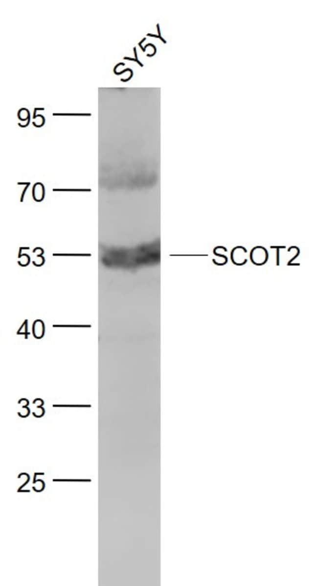 SCOT2 Rabbit anti-Human, Polyclonal, Bioss 100 μL; Unconjugated ...