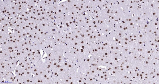 Notch3/4 Rabbit anti-Human, Polyclonal, Bioss 100 μL; Unconjugated ...