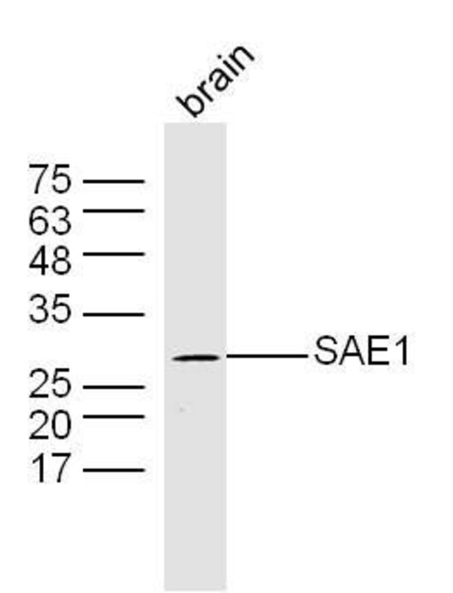 SAE1 Rabbit anti-Human, Polyclonal, Bioss 100 μL; Unconjugated ...