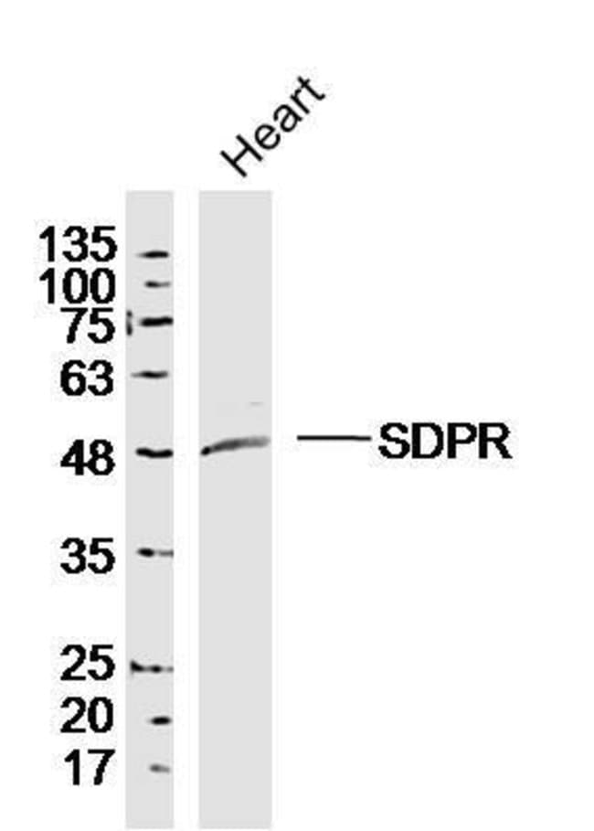 SDPR Rabbit anti-Human, Polyclonal, Bioss 100 μL; Unconjugated ...