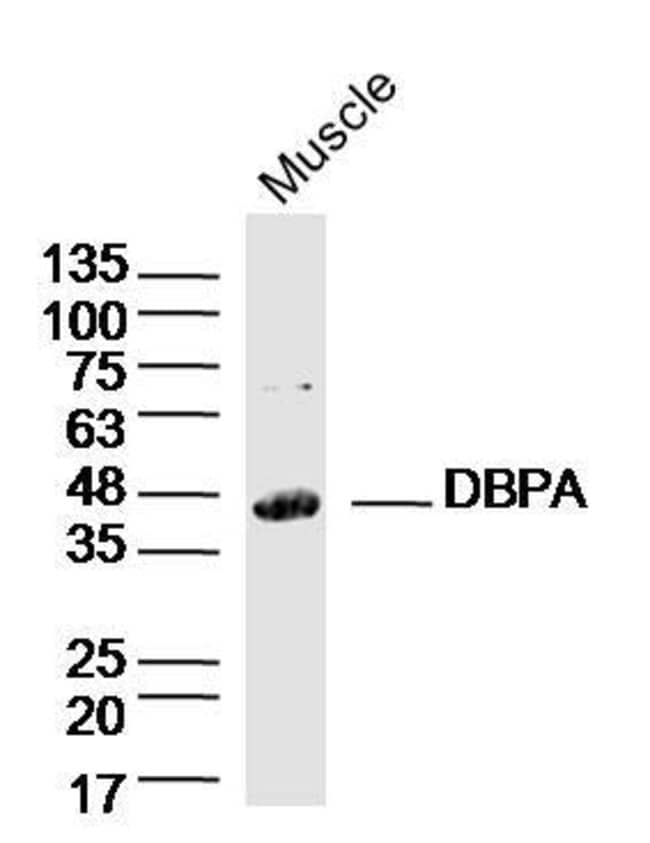DBPA Rabbit anti-Human, Polyclonal, Bioss 100 μL; Unconjugated ...