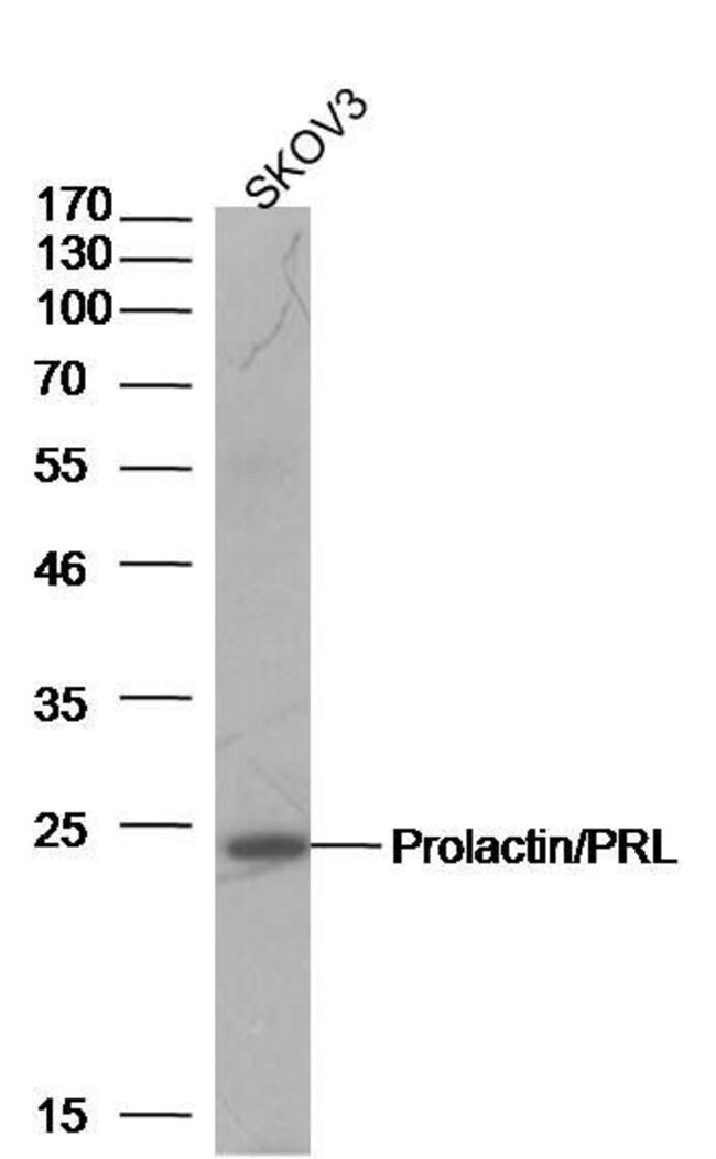 Prolactin/PRL Rabbit anti-Human, Polyclonal, Bioss 100 µL; Unconjugated ...