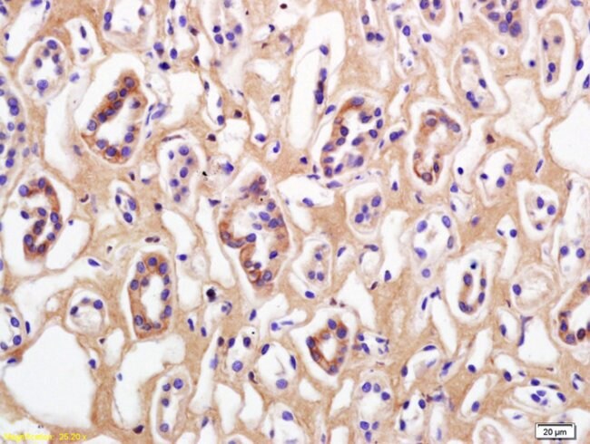 Phospho-Beta Catenin (Thr41, Ser45) Rabbit anti-Human|Mouse|Rat ...