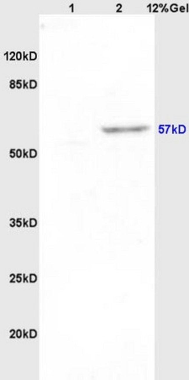 Pancreatic Amylase Rabbit anti-Human, Polyclonal, Bioss 100 μL ...