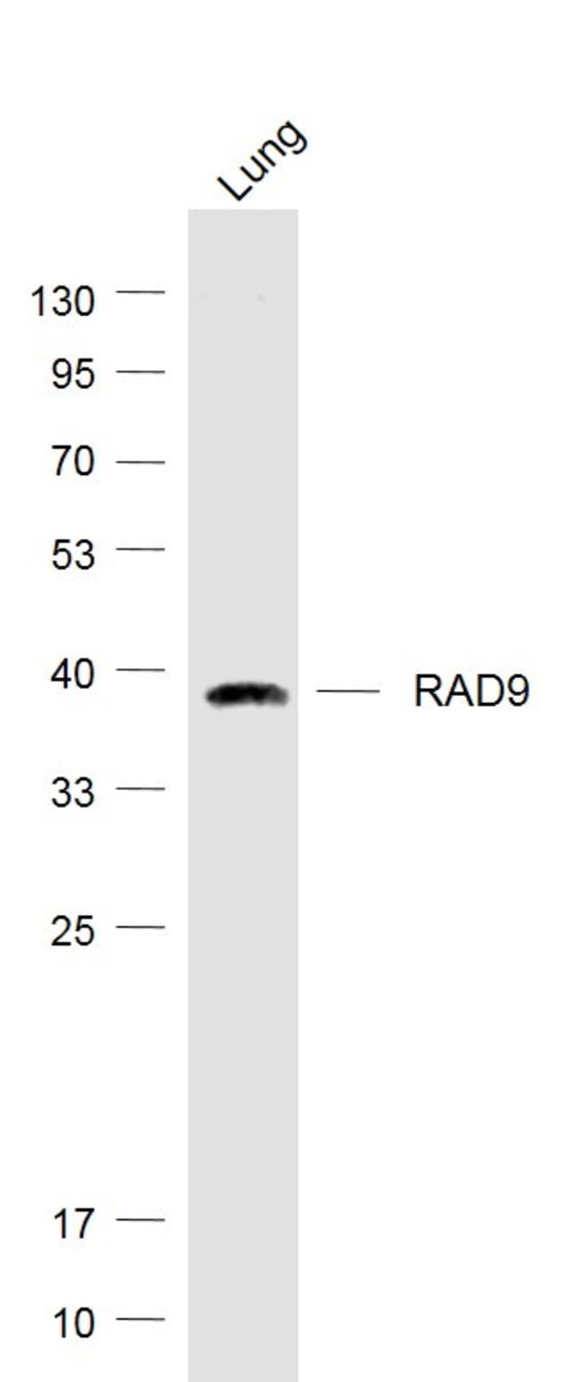RAD9 Rabbit anti-Human, Polyclonal, Bioss 100 μL; Unconjugated ...