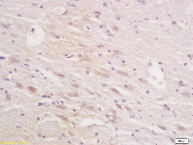 Squalene Epoxidase Rabbit anti-Human, Polyclonal, Bioss 100 μL ...