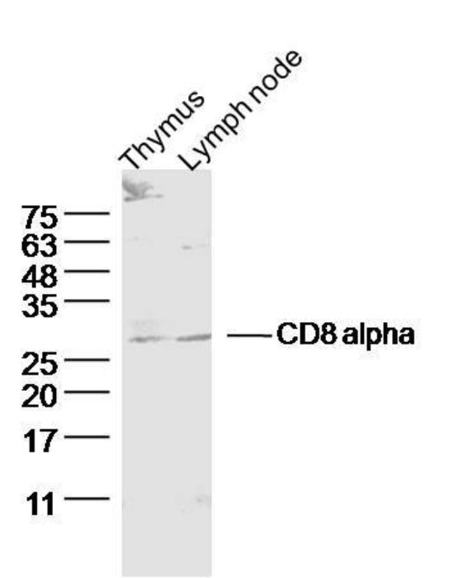 CD8 alpha Rabbit anti-Human, Polyclonal, Bioss 100 μL; Unconjugated ...