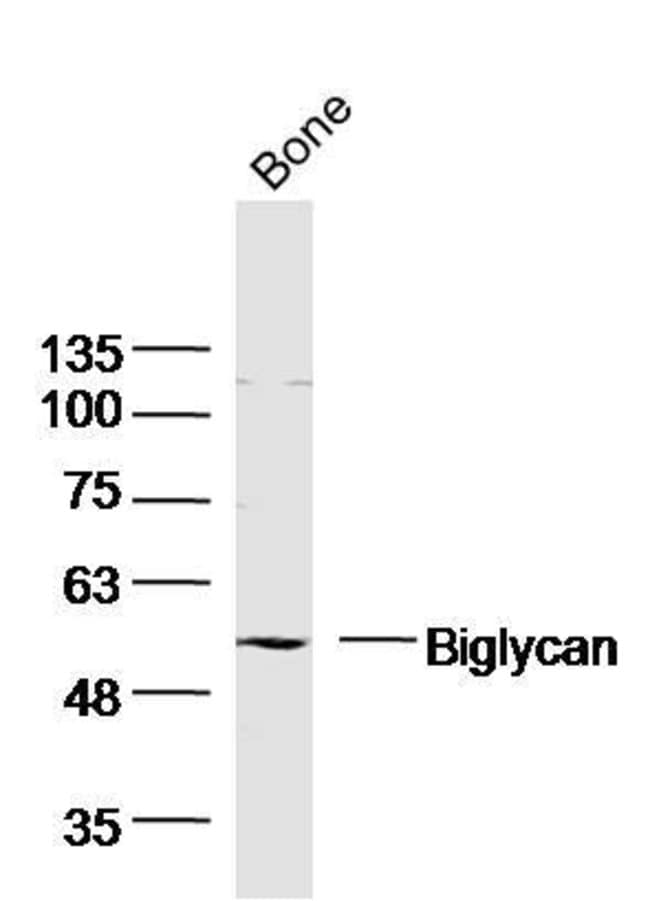 Biglycan Rabbit anti-Human, Polyclonal, Bioss 100 μL; Unconjugated ...