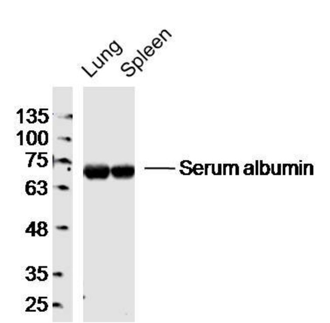 Serum albumin Mouse anti-Human, Clone: 3F4, Bioss 100 μL; Unconjugated ...