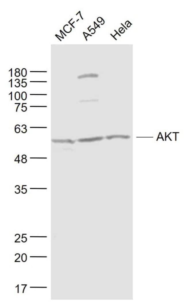 AKT Monoclonal Antibody (10D8), Bioss 100 μL; Unconjugated:Antibodies ...