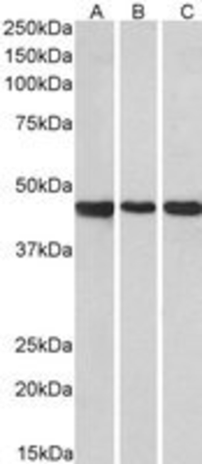 Prokineticin Receptor 2 Polyclonal Antibody, Invitrogen 100 μg ...