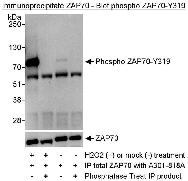 Phospho-ZAP70 (Tyr319) Rabbit anti-Human, Polyclonal, Bethyl ...