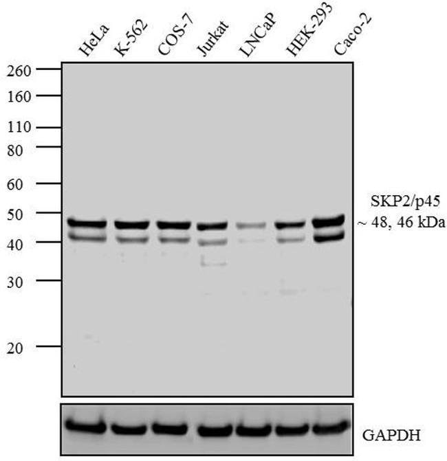 SKP2 Monoclonal Antibody (SKP2-8D9), Invitrogen 100 μg; Unconjugated ...