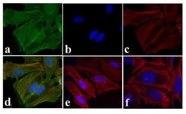 Phospho-EGFR (Tyr1173) Polyclonal Antibody, Invitrogen 100 μL ...