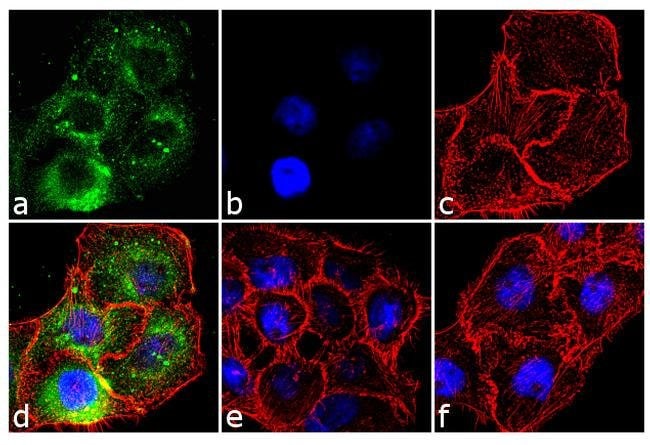 Phospho-EGFR (Tyr1173) Recombinant Rabbit Monoclonal Antibody (17H14L5 ...