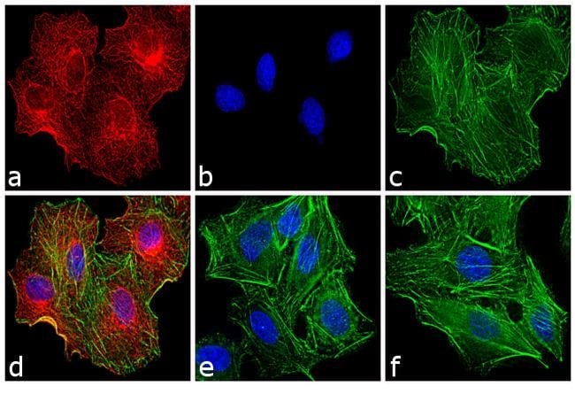 F(ab')2-Donkey anti-Rat IgG (H+L) Highly Cross-Adsorbed Secondary ...