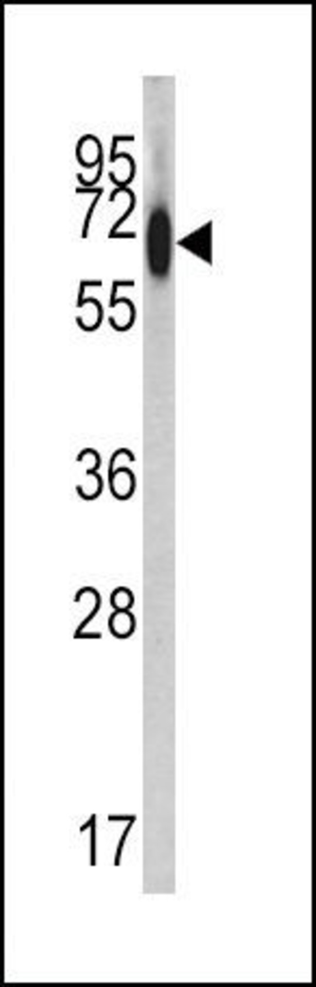 Human Serum Albumin Polyclonal Antibody, Invitrogen 200 μL ...